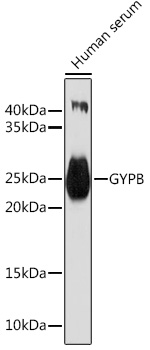 GYPB Rabbit pAb-多克隆抗体- ABclonal